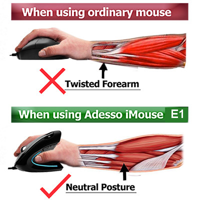 Adesso iMouse E1 Vertical Ergonomic Illuminated Mouse, Ergonomic Conto ...
